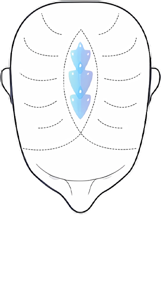 Breast Reconstruction & Regenerative Medicine - Bimini Health Tech